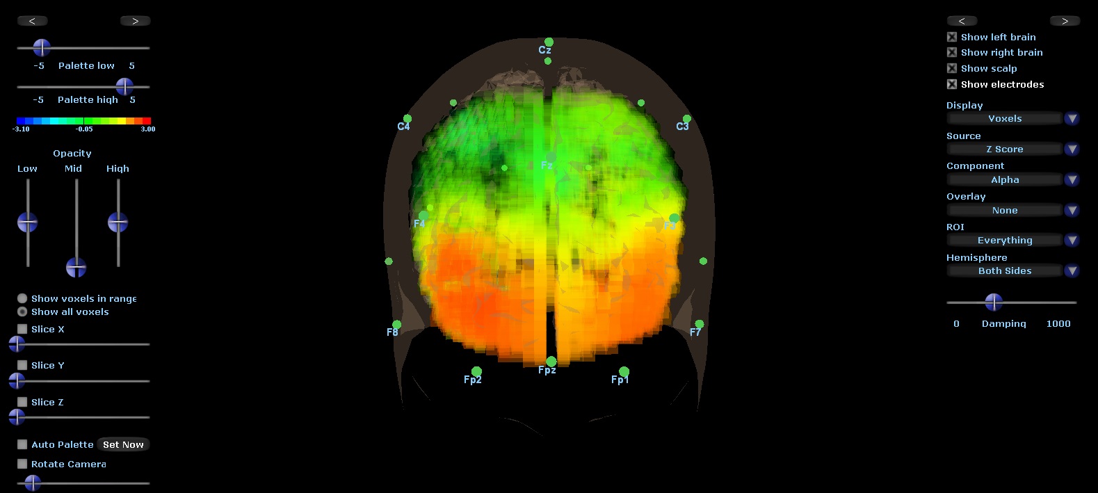 Brainavatar - Brain Mapping and Neurofeedback Systems