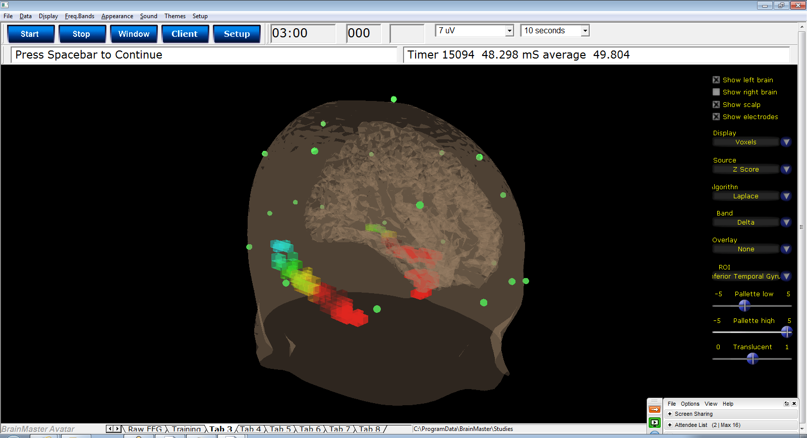 Brainavatar - Brain Mapping and Neurofeedback Systems