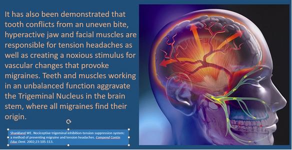 TMJ Migraine Headache Treatment By Board-Certified TMJ Expert