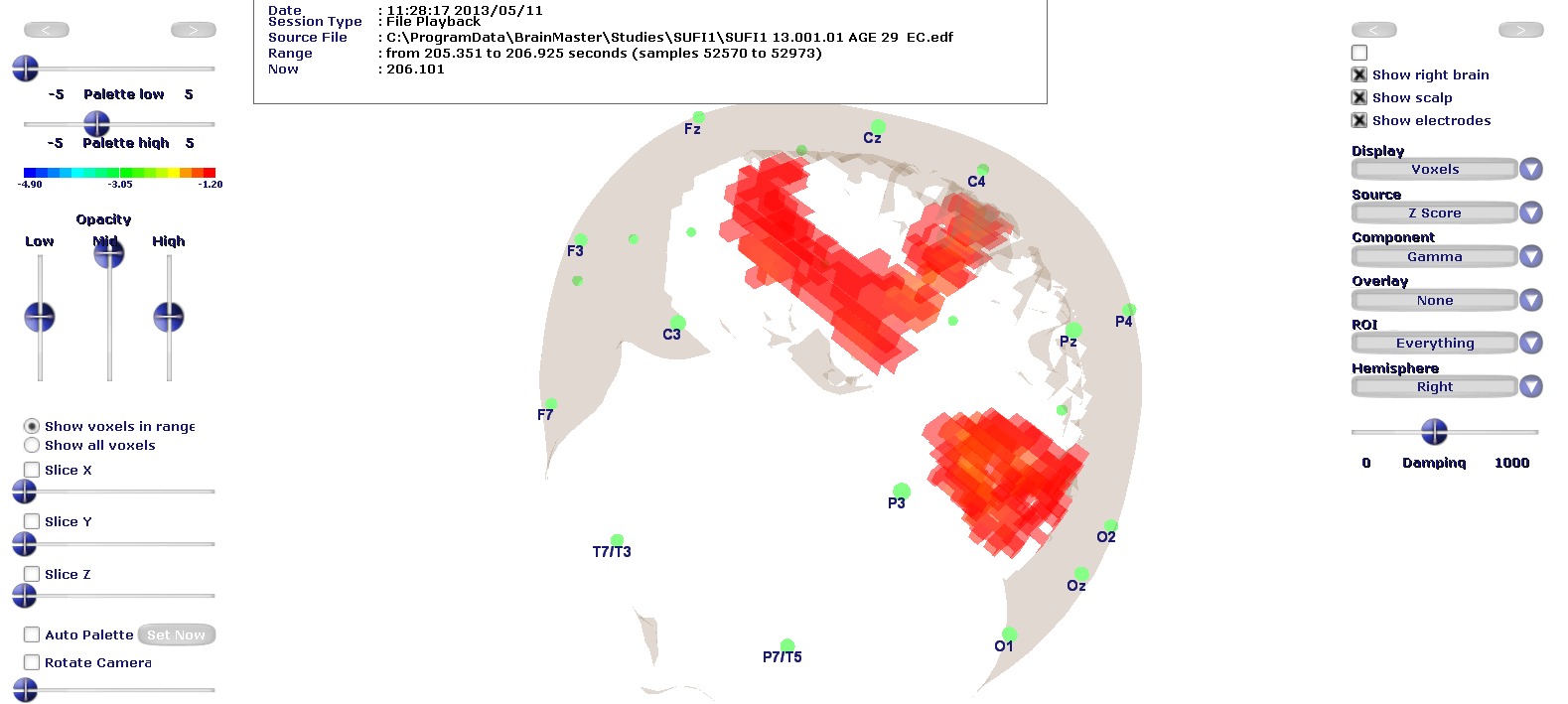 Brainavatar - Brain Mapping and Neurofeedback Systems