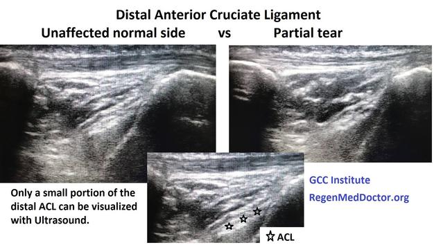 Ultrasound Diagnosis