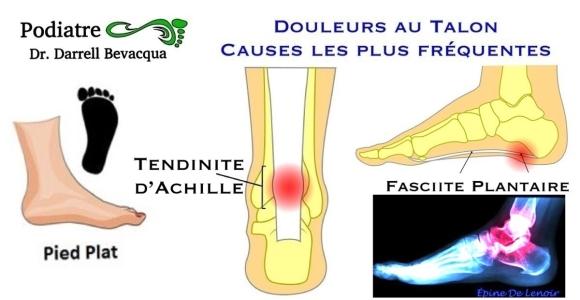 Tendon d’achille Tendinite d'achille douleur solutions