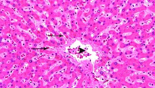 Pathology Expert Witness and Litigation Support Services - expert ...