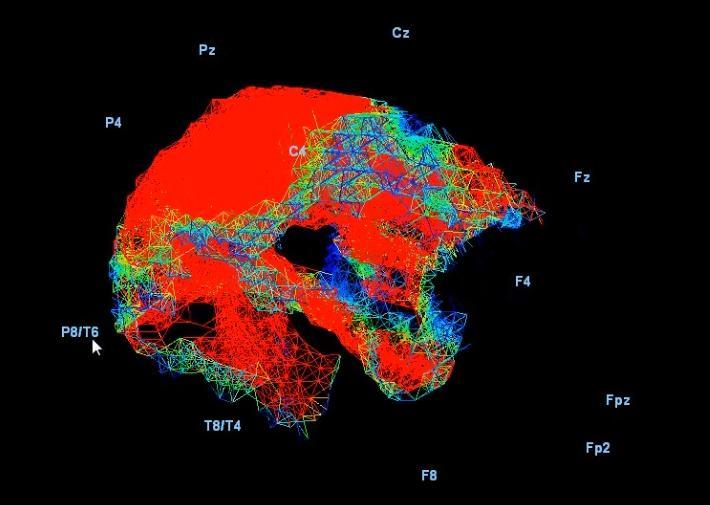 Brainavatar - Brain Mapping and Neurofeedback Systems