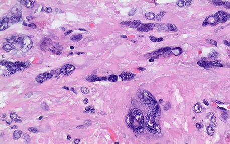 Pathology Expert Witness and Litigation Support Services - expert ...