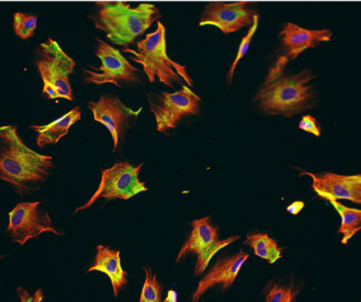 Home [www.crarylab.org]